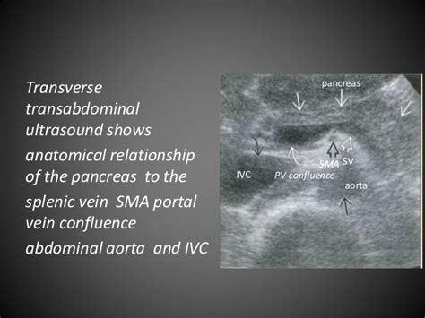 Pancreatic Sonographic Anatomy