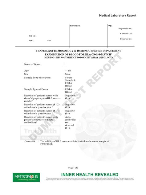 H0235 Cdc Hla Cross Match Total Tb Cells Heparin Edta Blood Pdf