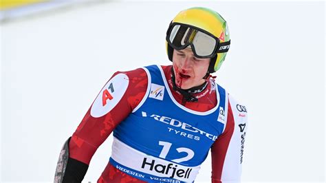 Raphael Haaser Freundin Fabiana Dorigo Scherzt über Zahn Crash Des Österreichers In Hafjell Und