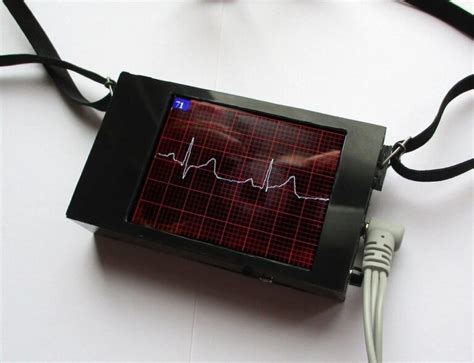 An Arduino ECG Device With An Integrated Display Arduino Blog