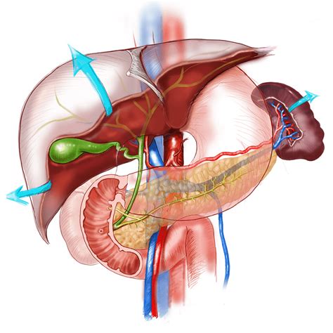 Websurg Ircads Online University Ircad