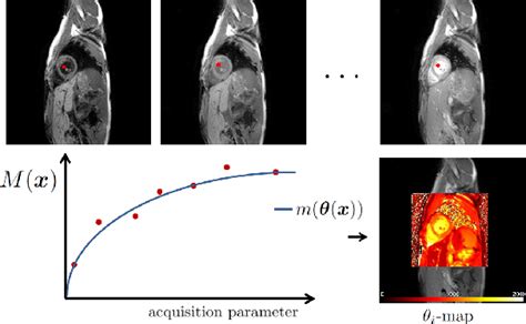 Figure 1 From Pca Based Groupwise Image Registration For Quantitative