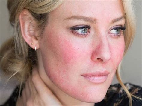 Do Not Ignore It A Common Sign On Your Face That May Indicate A Fatal