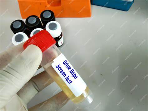Premium Photo Urine Drug Screen Test Sample Urine Drug Screening