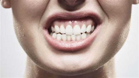Qué es el bruxismo Causas principales y tratamiento Clínica dental