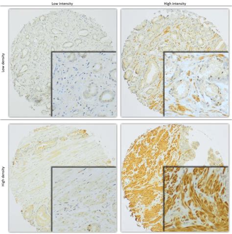 Examples Of High And Low Intensity And Density Of Pdgfr β Download