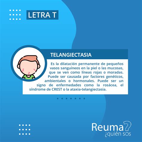 Reuma 🌐 ¿qué Es La Telangiectasia Es La Dilatación Permanente De Pequeños Vasos Sanguíneos En