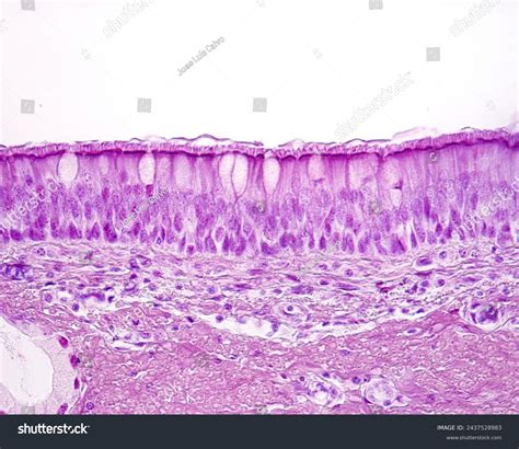 Categoría «histologia Traquea De Fotos E Imágenes Shutterstock