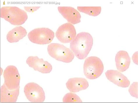 细胞计数终结者Image J的3个细胞计数法 哔哩哔哩