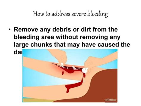 Basic First Aid Bleeding Pptx