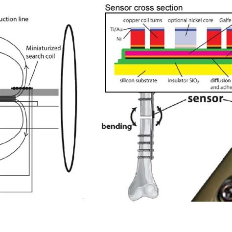 Pdf Micromachined Magnetoelastic Sensors And Actuators For Biomedical Devices And Other