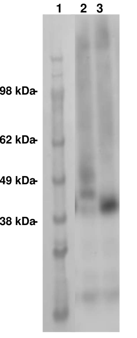 Pathhunter® Cho K1 Opn5 β Arrestin Orphan Gpcr Cell Line Discoverx