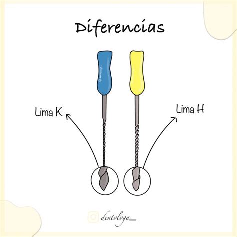 diferencia entre lima h y lima k endodoncia odontología higiene