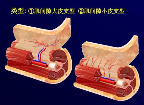 图文详解:穿支皮瓣的解剖与进展! 德医医学 助力医学教育发展! 图文详解:穿支皮瓣的解剖与进展! 德医医学 助力医学教育发展!