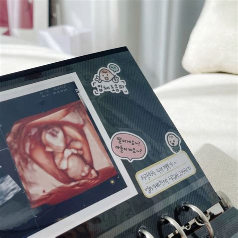 임신 16주차 기록 초음파 2차기형아검사 성별 커피 배크기 육회 입덧 분수토 네이버 블로그