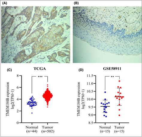 Tmem184b Promotes Proliferation Migration And Invasion And Inhibits