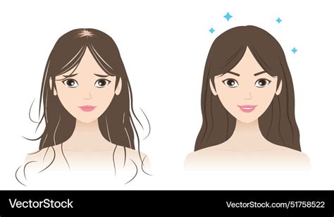 Comparison Of Hair Loss And Healthy Royalty Free Vector