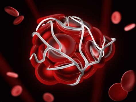 Massive Transfusion Protocol Understanding The Clotting Cascade