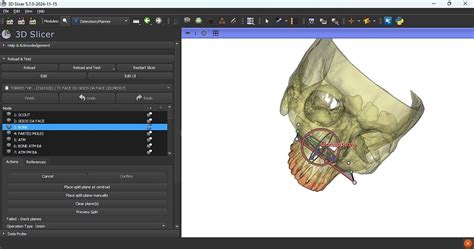 Osteotomy Planner Does Not Work Support 3d Slicer Community