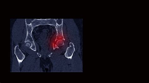 Ct Scan Pasien Mengalami Serangan Fisik Konsep Kedokteran Dan Teknologi