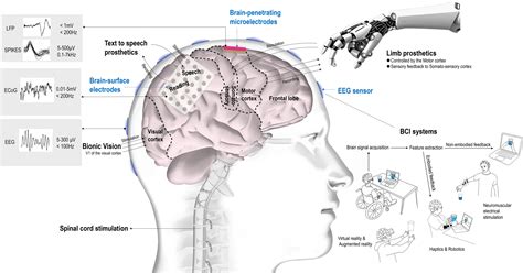 Braincomputer Interfaces In 20232024 Chen 2025 Brain‐x Wiley