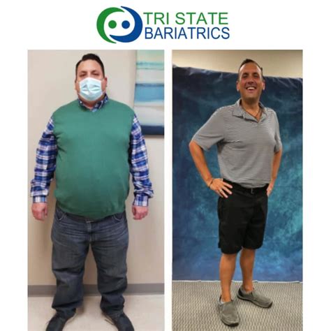 Tri State Bariatrics Meet Frank With The Help Of The Tri State