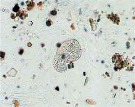 Light Microscope Micrograph Of A Grass Pollen Grain In Which The Exine Download Scientific