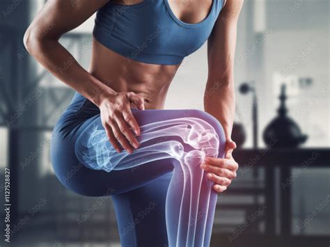 Foto de Stock Una mujer en forma con una vista de radiografía de la