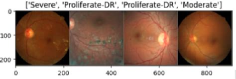 Figure 9 From Diabetic Retinopathy Detection Using Quantum Transfer Learning Semantic Scholar