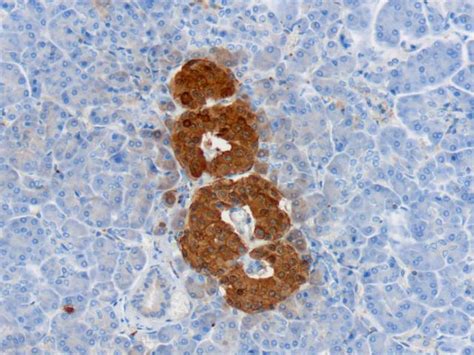 Neuron Specific Enolase Nse Immnunohistochemistry Control Histology