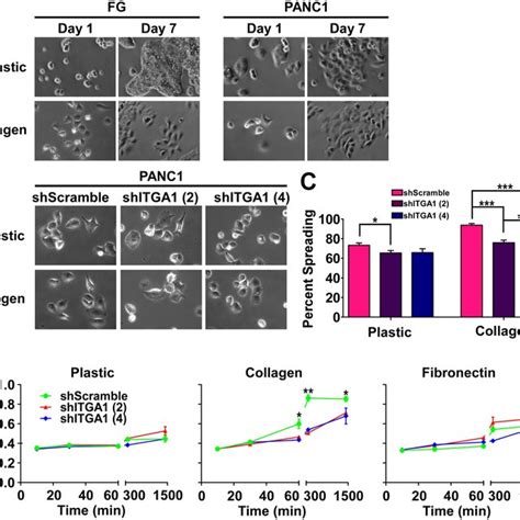 Itga1 Mediates Tgfβcollagen Induced Emt And Gemcitabine Resistance In