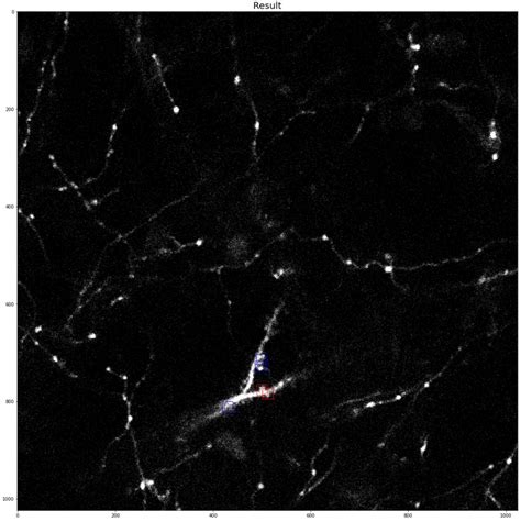 Github Htyangs Spine Analyze Automatic Label Dendritic Spines By