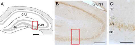 Sex And Chronic Stress Alter The Distribution Of Glutamate Receptors