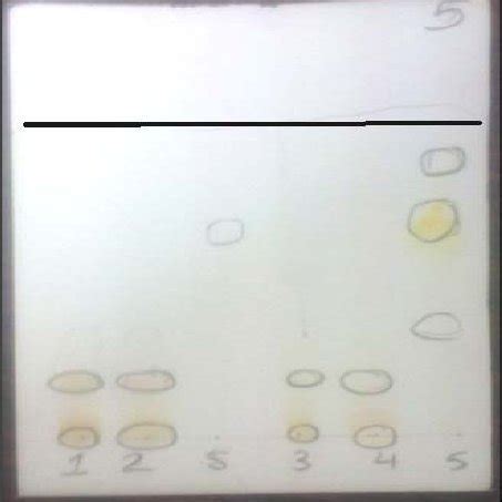 TLC Analysis Of Different Extracts Download Scientific Diagram