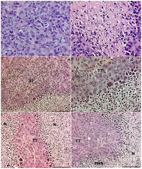Histology Of Tumor Tissues From Mice With Or Without At A Fourteen