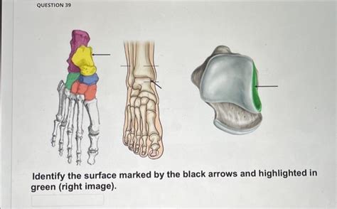 Solved Question 2 Identify The Passageway Marked By The