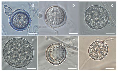 Identification And Isolation Pattern Of Globisporangium Spp From A Sanionia Moss Colony In Ny