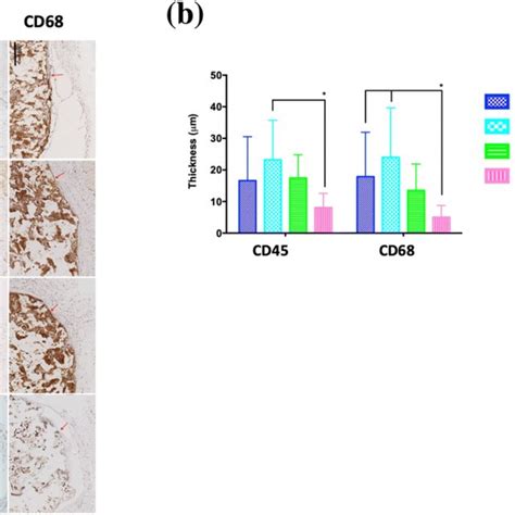 Implant Tissue Interface And Presence Of Inflammatory Cells Over The 12 Download Scientific