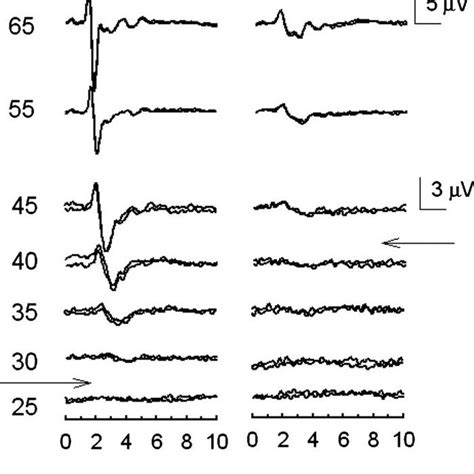Representative Abr Click Waveforms For A Single Gecko And Anole Showing