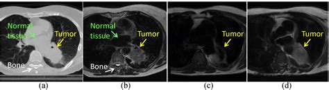 Mri Synthesized From A Representative A Ct Image Using C Download Scientific Diagram