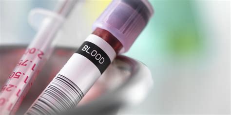 Virus O Batterio Un Test Del Sangue Per Diagnosticare L Infezione MediMagazine