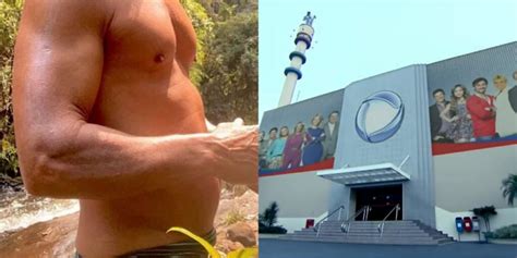 Ator galã da Globo quase perdeu parte do corpo e culpou Record