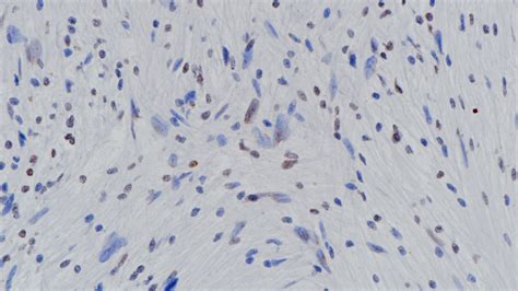 H3k27me3 杭州百凌生物科技有限公司 官方网站
