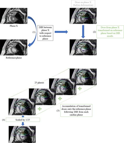 1 2 Workflow For Estimation Of Cumulative Dose Using Dose
