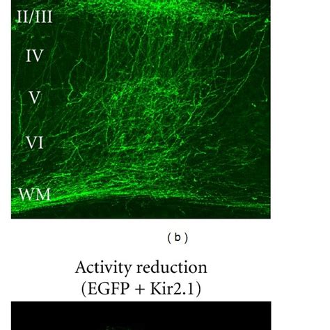 Visualization Of Callosal Axon Projections And An Effect Of Activity Download Scientific