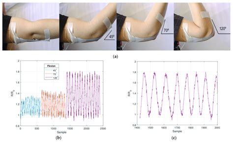 Resistive Strain Sensor Attached To The Elbow With Three Ranges Of Download Scientific Diagram