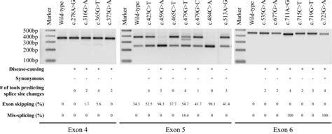 In Vitro Minigene Analysis Of Select F9 Variants In Exons 4 5 And 6