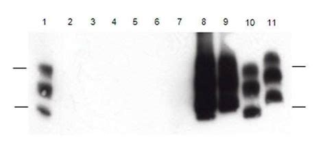 Analysis Of Brain Prp Res Of Suspected Cjd Patients Using Streptomycin Download Scientific Diagram