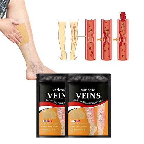 Ripley PARCHES PARA VARICES VENAS HINCHADAS