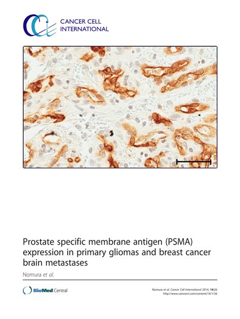 Pdf Prostate Specific Membrane Antigen Psma Expression In Primary
